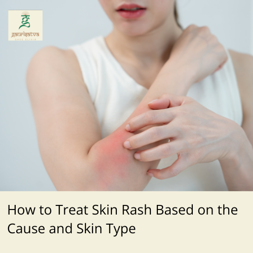 How to Treat Skin Rash Based on the Cause and Skin Type – Gaurisatva